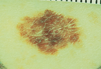 Case 37 Clinical Gate