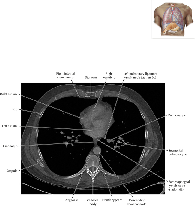 Thoracic Lymph Nodes Clinical Gate