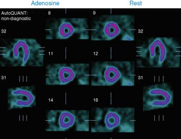 Case 32 Clinical Gate