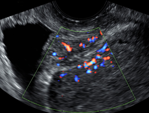 Case 8 Clinical Gate