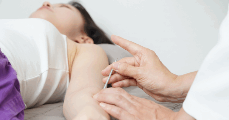 How Often Should You Get Acupuncture? A Complete Guide to Building a ...