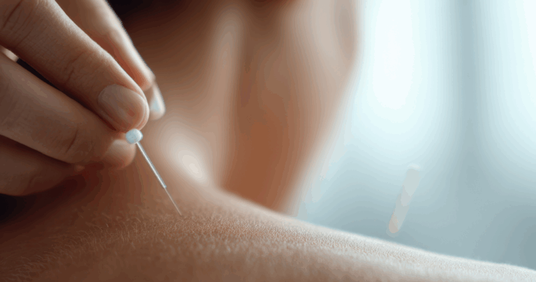 How Often Should You Get Acupuncture? A Complete Guide to Building a ...